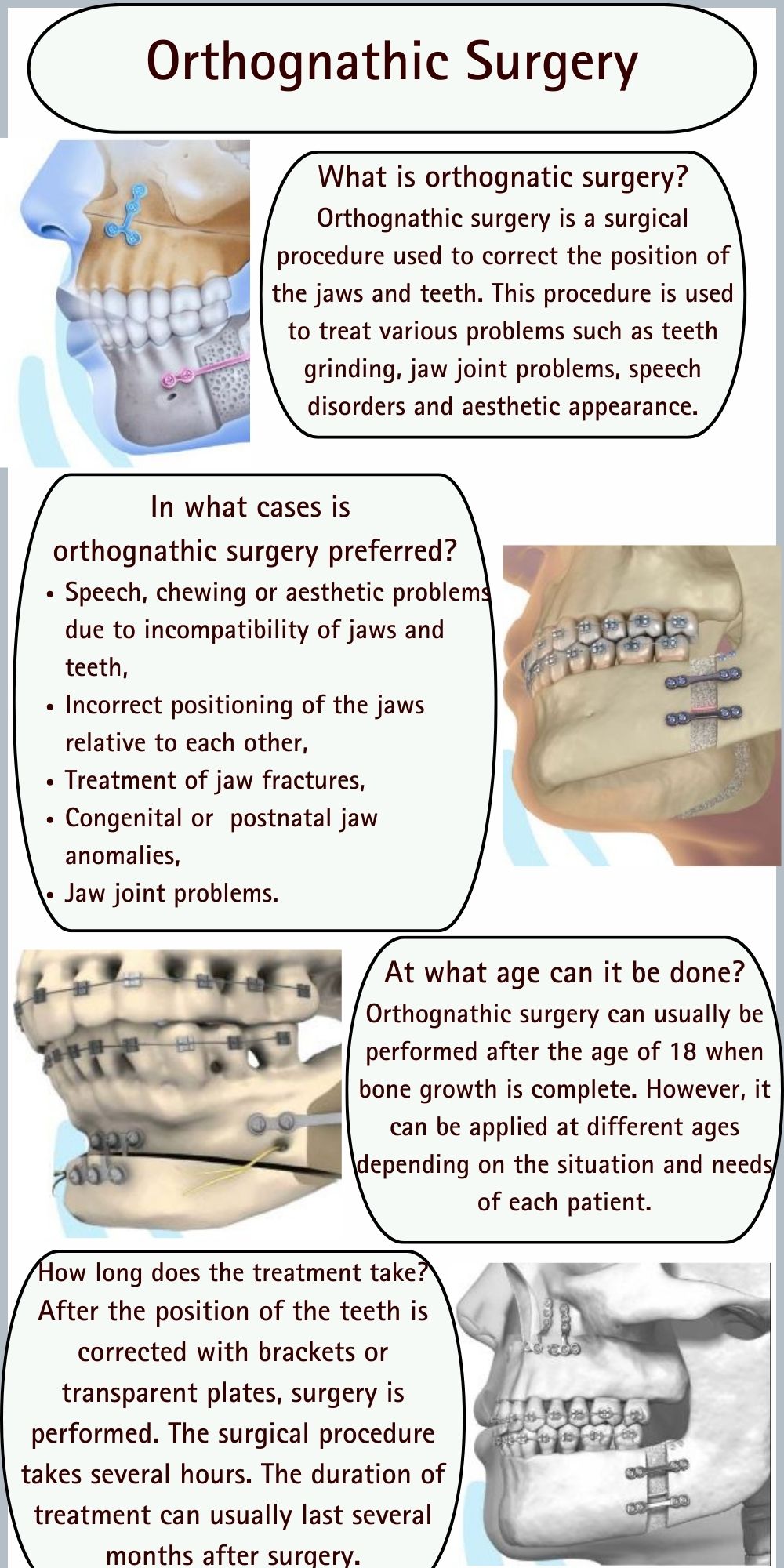 Orthognathic-Jaw Correction Surgery Dental Health Clinic Turkey